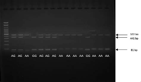 Leptin Gene Polymerase Chain Reactionrestriction Fragment Length