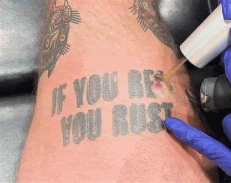 Heres What Its Really Like To Get A Tattoo Removed Insidehook