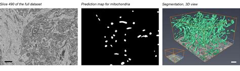 Deepmib User Friendly Tool For Training Of Deep Learning Network For Biological Image