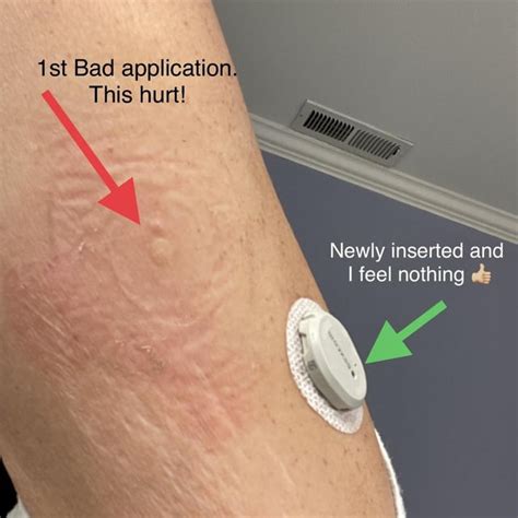 I Dont Think My Chart Is Supposed To Look Like This Rdexcom