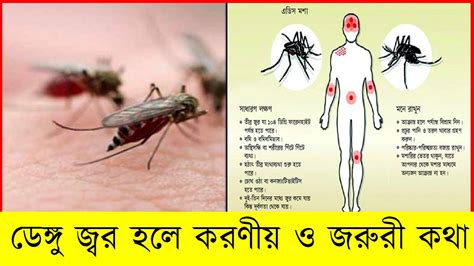 ডেঙ্গু জ্বর হলে করণীয় এবং সতর্কতা। জনস্বার্থে শেয়ার করুন Youtube