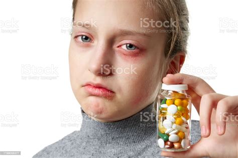 알레르기 반응 피부 발진 소녀의 얼굴의 클로즈 뷰 초상화 눈과 입술에 있는 피부의 빨갛게 그리고 염증 면역 체계 질환 어린이 손에 정제 와 알약의 병 건강관리와 의술에 대한