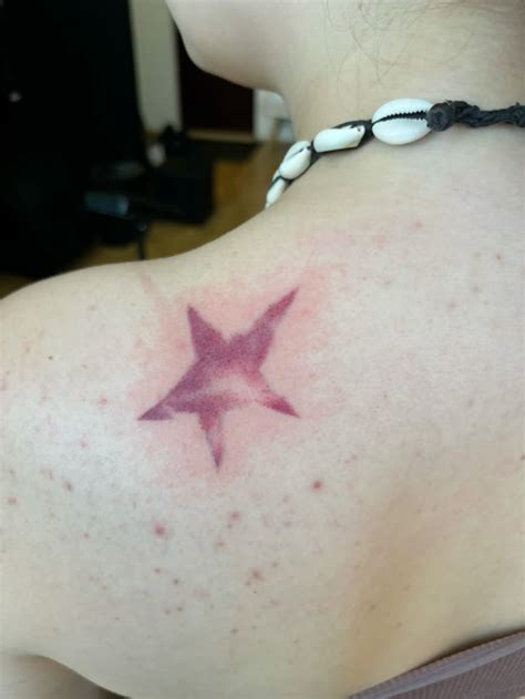 Jojo Star Birthmark