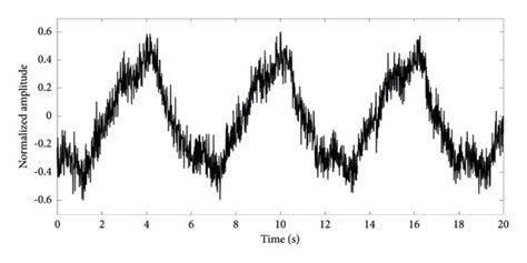 Chest Surface Motion Modeling Signal Download Scientific Diagram