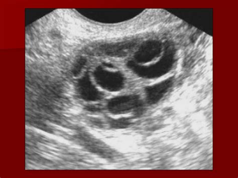 Маточные кровотечения как ургентное состояние Дифференциальная