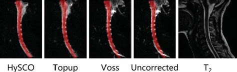 Figure 2 From Geometric Evaluation Of Distortion Correction Methods In