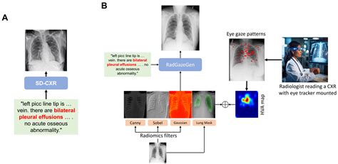 논문 리뷰 Radgazegen Radiomics And Gaze Guided Medical Image Generation