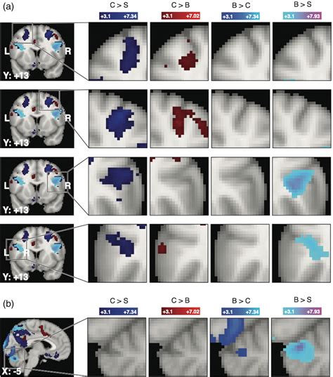 Differences In Responses To Condition A Several Clusters In The
