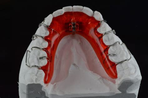 Kfo Cs Zahntechnik In Landsberg Am Lech