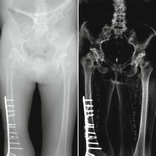 Attenuation Window Level Window Width A And X Ray Dark Field Download Scientific