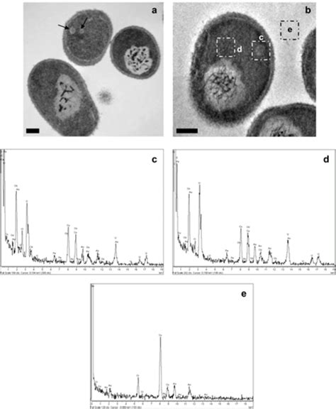 2 Unpolluted Culture Of Paracoccus Sp De2007 Cells Showing Vesicles Download Scientific