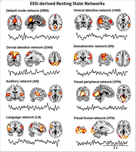 Broadband Eeg‐derived Resting State Networks Rsns The Spatial Map Download Scientific