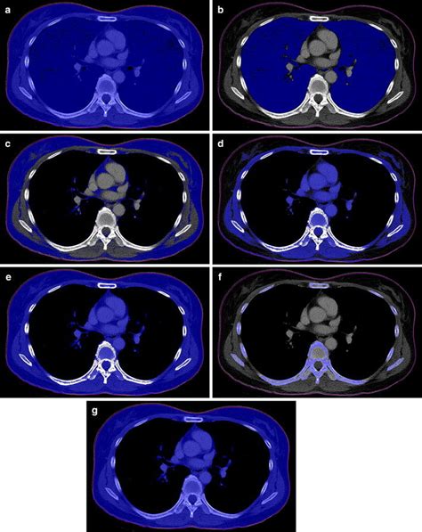 Quantitative Measurement Of Various Thoracic Components Using An Download Scientific Diagram