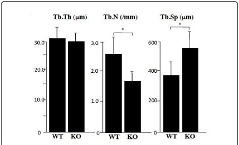 D Bone Histomorphometry In Secondary Cancellous Bone Area Of Ko Mice