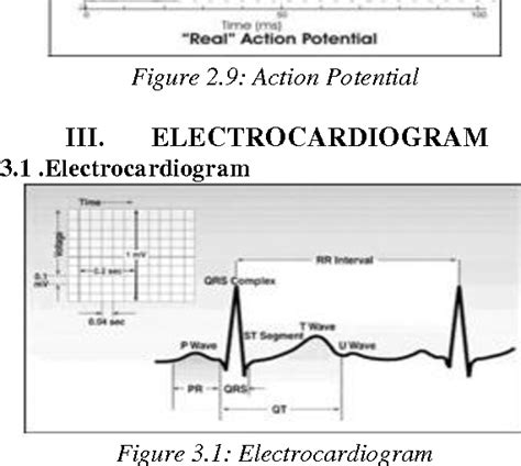 Figure 3 1 From Denoising Of Ecg A Discrete Time Approach Using Dwt Semantic Scholar