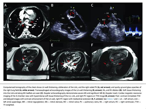 Multimodality Imaging Of The Case Download Scientific Diagram