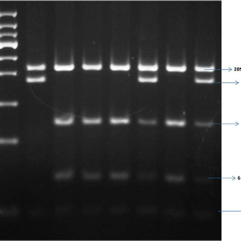 Restriction Fragment Length Polymorphism Gel Picture Of Pon1 Q192r Gene Download Scientific