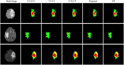 frontiers a medical image segmentation method based on multi