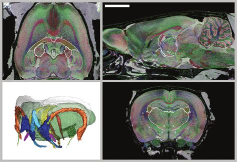 Volumetric Segmentation Environment In Itk Snap Orthogonal Views Of Download Scientific