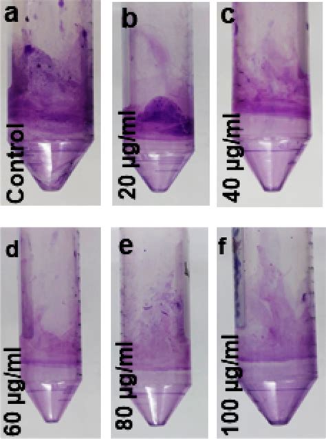 Attachment Of S Typhi On The Polystyrene Surface A F Panel Of Images Download Scientific