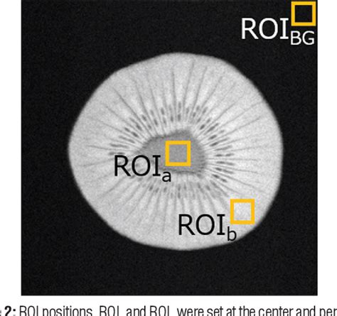 Figure 2 From Denoising Using Noise2void For Low Field Magnetic