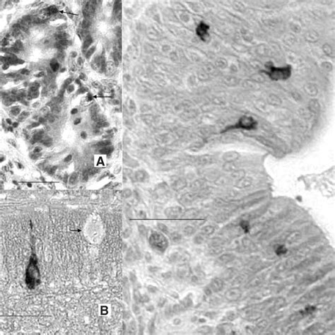A A Section Of The Duodenum Mucosa Revealing Cross Sections Of Glands Download Scientific