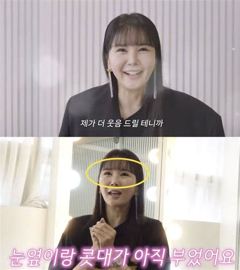 장영란 “눈뜨는 힘 부족해 쌍커풀 내려와 25년만 성형 공개” 브릿지경제