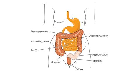 Sigmoidectomy Surgery For Ibd Ibdrelief