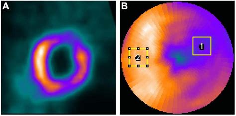 A The 3d Voi Used For Voxel Based Error Calculation B Sample Rois