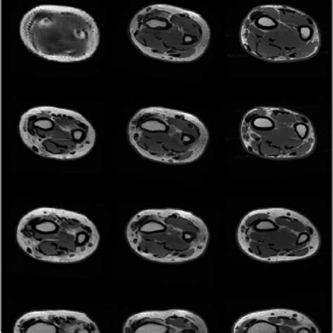Regularized Eit From Multifrequency Measurements Using Cascaded Download Scientific Diagram
