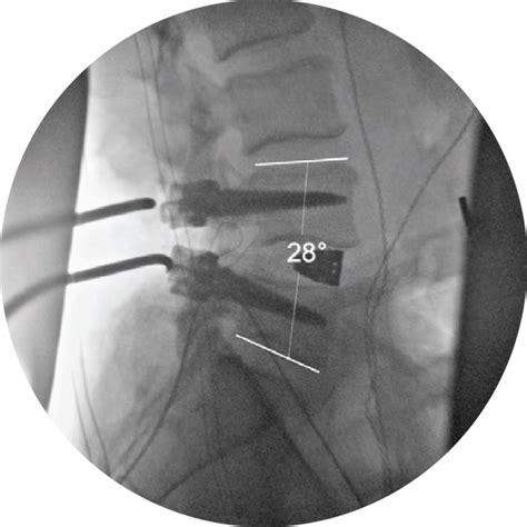 Proaxis Brochure Mizuho Osi