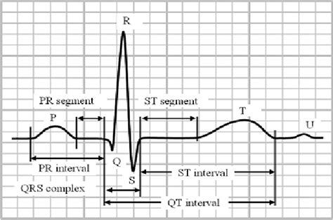 Figure 2 From Selecting Features Of Single Lead Ecg Signal For