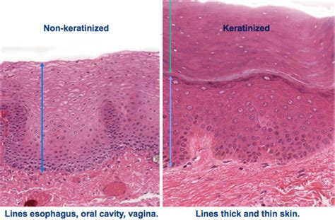 Keratinized Vs Non Keratinized Stratified Squamous Epithelium