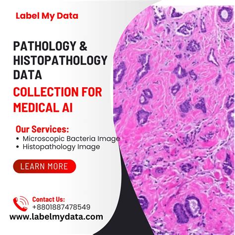 Label My Data On Linkedin Ai Healthcareai Medicaldata