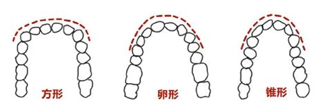 优诺口腔 矫正过程中害怕拔牙怎么办扩弓了解下 知乎