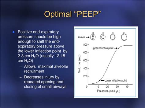 Ppt Ards Powerpoint Presentation Free Download Id3928837