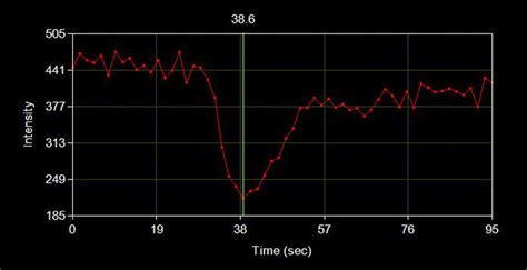DSC Signal V Gd Questions And Answers In MRI