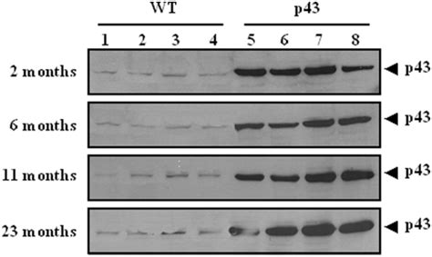 P43 Protein Levels In Quadriceps Muscle Extracts From Transgenic Mice