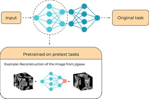 Typical Workflow Of Radiotherapy Treatment Planning And Delivery Top