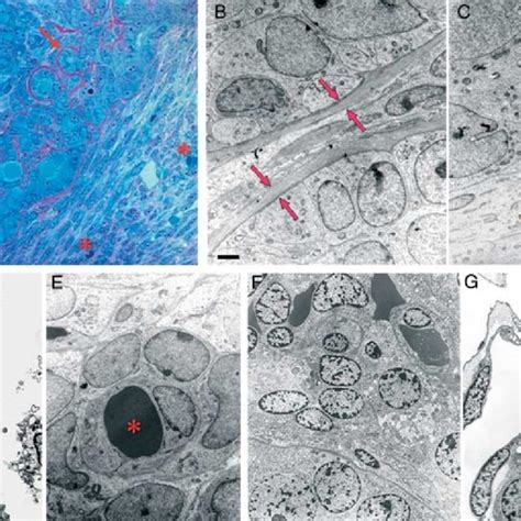Light And Transmission Electron Micrographs Of Testicular Lesions In Download Scientific