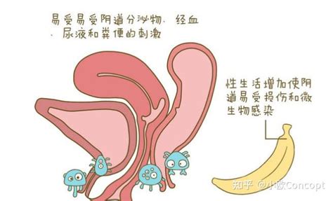过早开始性生活会有什么后果 知乎