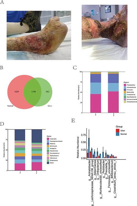 Microbiome Diversity Analysis A E Violin Charts Of α Diversity