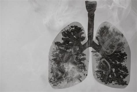 When To Worry About Pulmonary Nodules