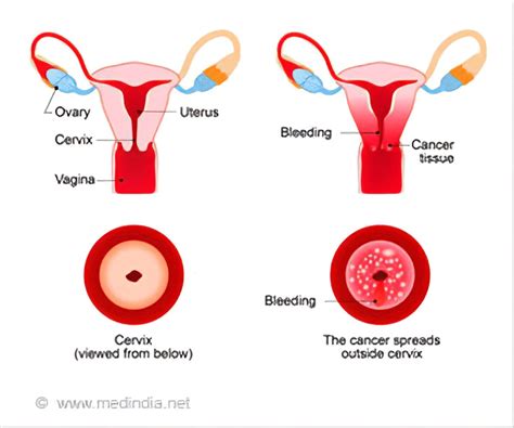 Cervix Anatomy