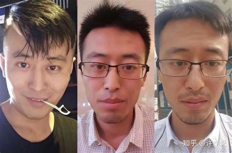 忍一时卵巢囊肿，退一步乳腺增生：别生气了，真的会死 知乎