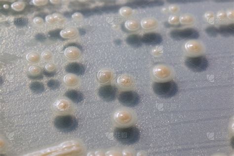 实验室培养培养皿上的酵母菌。