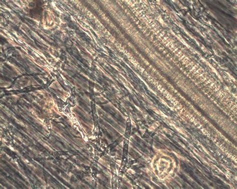 Disease Suppressive Trichoderma Spp Isolated From Compost Growing On