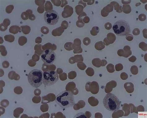 Apa Perbedaan Antara Itp Dan Ttp Prodiffs