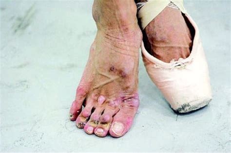 Ballerinas Feet Rwtf