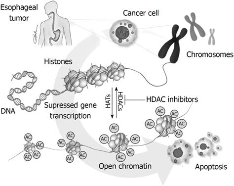 Concept Of Histone Deacetylases In Cancer Reflections On Esophageal